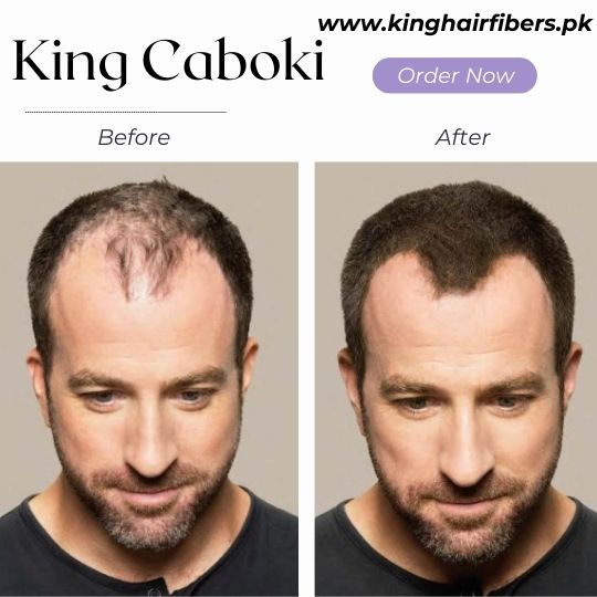 Caboki Hairline Optimizer in Pakistan